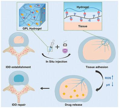 Injectable Inflammation-Responsive Hydrogels for Microenvironmental ...