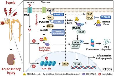 Histone H3K18 and Ezrin Lactylation Promote Renal Dysfunction in Sepsis ...