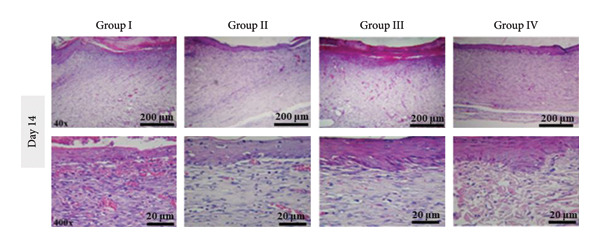 Honey-Based Sodium Alginate-Polyvinyl Alcohol Hydrogel Containing Green ...