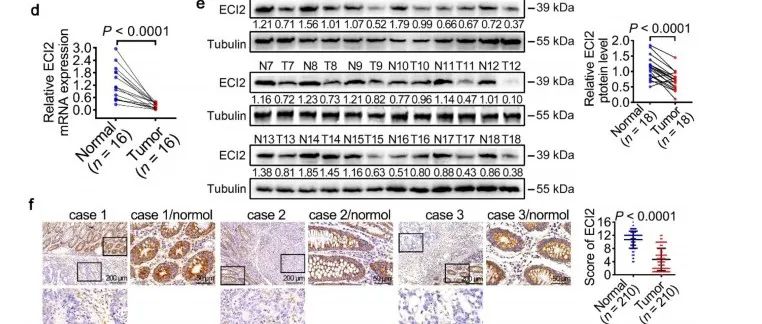Nat Commun | 南方医科大学李学农团队揭示脂质代谢酶ECI2通过减少中性粒细胞胞外网的形成来抑制结直肠癌 - Book学术
