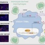 Dev Cell | 中山大学刘卓炜等发现，靶向VSIG4+组织驻留巨噬细胞增强肿瘤中T细胞的细胞毒性和免疫治疗效果！ - Book学术