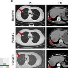 Adv Sci丨西安交通大学郭卉/徐峰研究揭示了Piezo 1在增强非小细胞肺癌肝转移免疫治疗反应中的关键作用 - Book学术