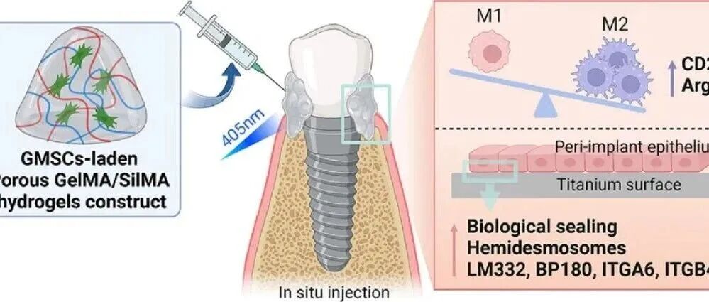 《Acta Biomaterialia》：多孔GelMA/SilMA水凝胶作为提供GMSC的递送载体 - Book学术